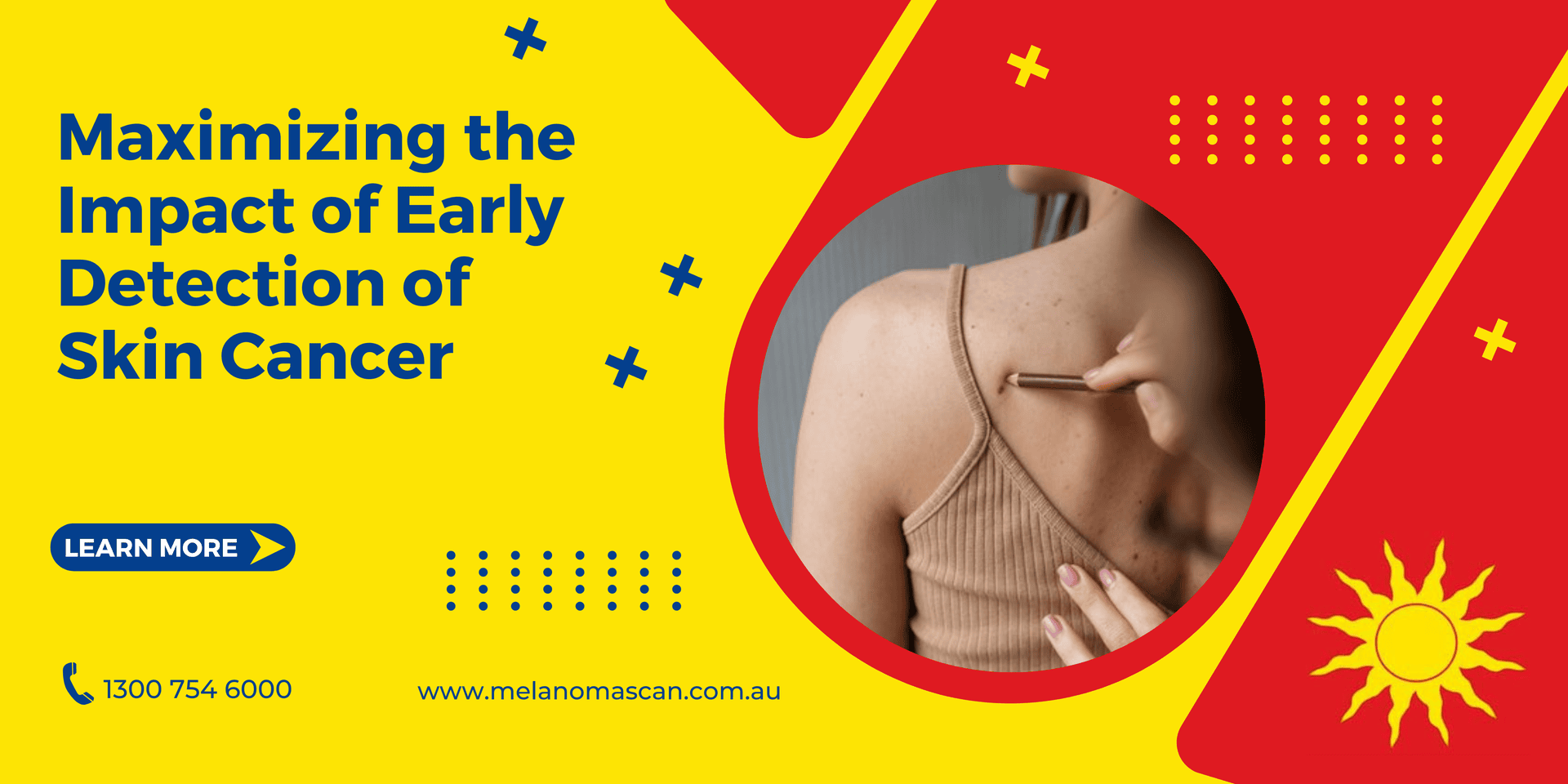 Maximising the Impact of Early Detection