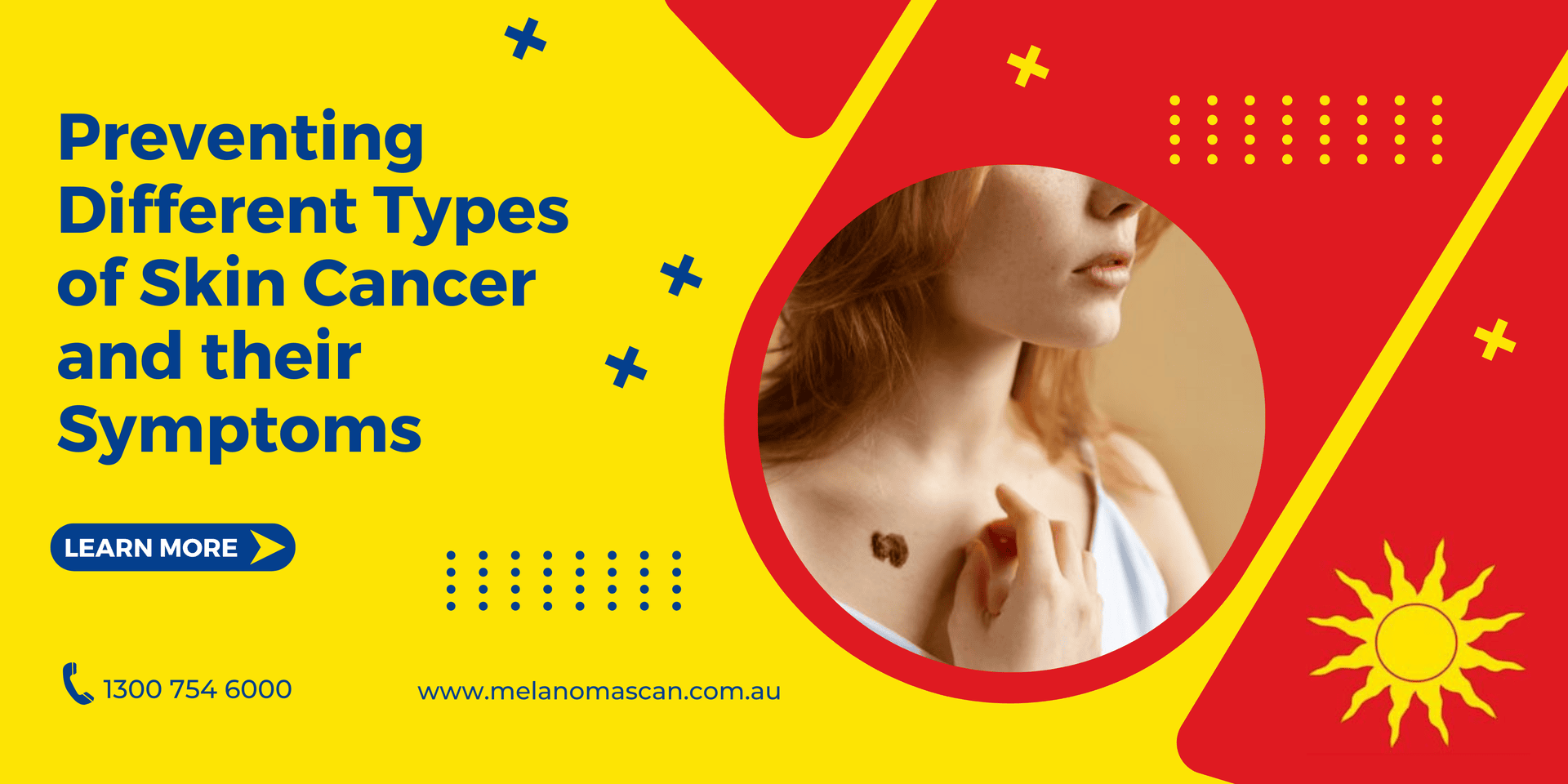 Preventing Different Types of Skin Cancer